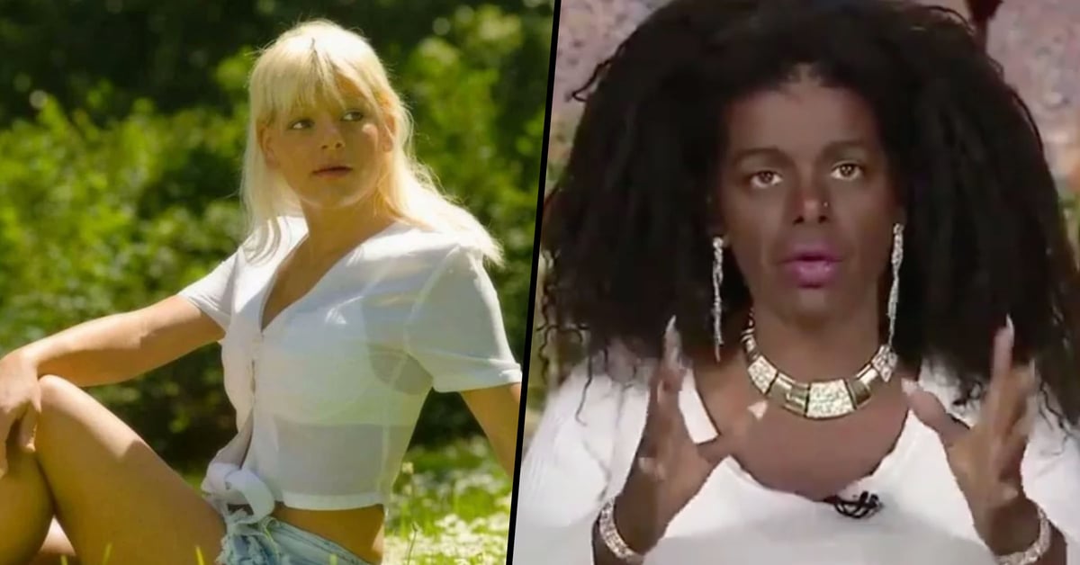 Model Who Took Melanin Injections Says She Hasn't Experienced Racism